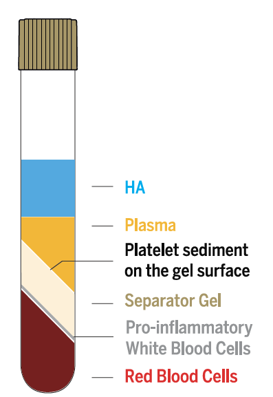 EN-HA_components_ENG | Regenlab USA LLC